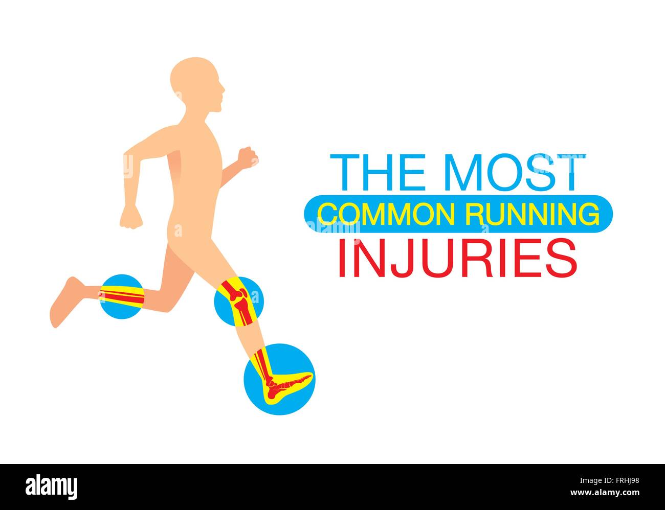 The most common running injuries Stock Vector Image & Art - Alamy The most common running injuries Stock Vector Image & Art - Alamy