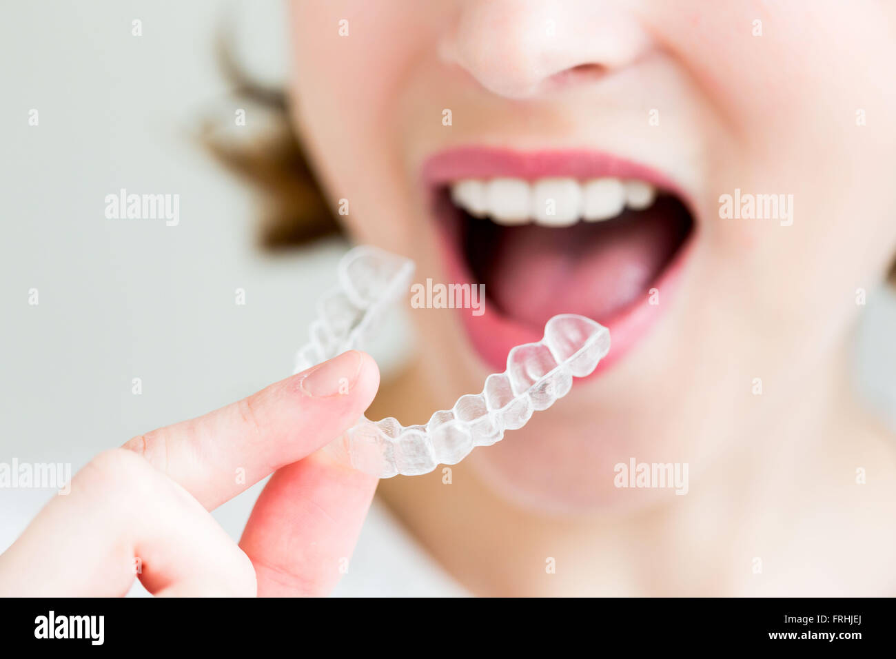 Woman using clear removable INVISALIGN aligners to straighten the teeth ...