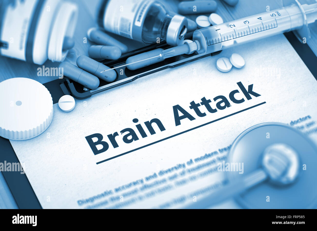 Brain injection hi-res stock photography and images - Alamy