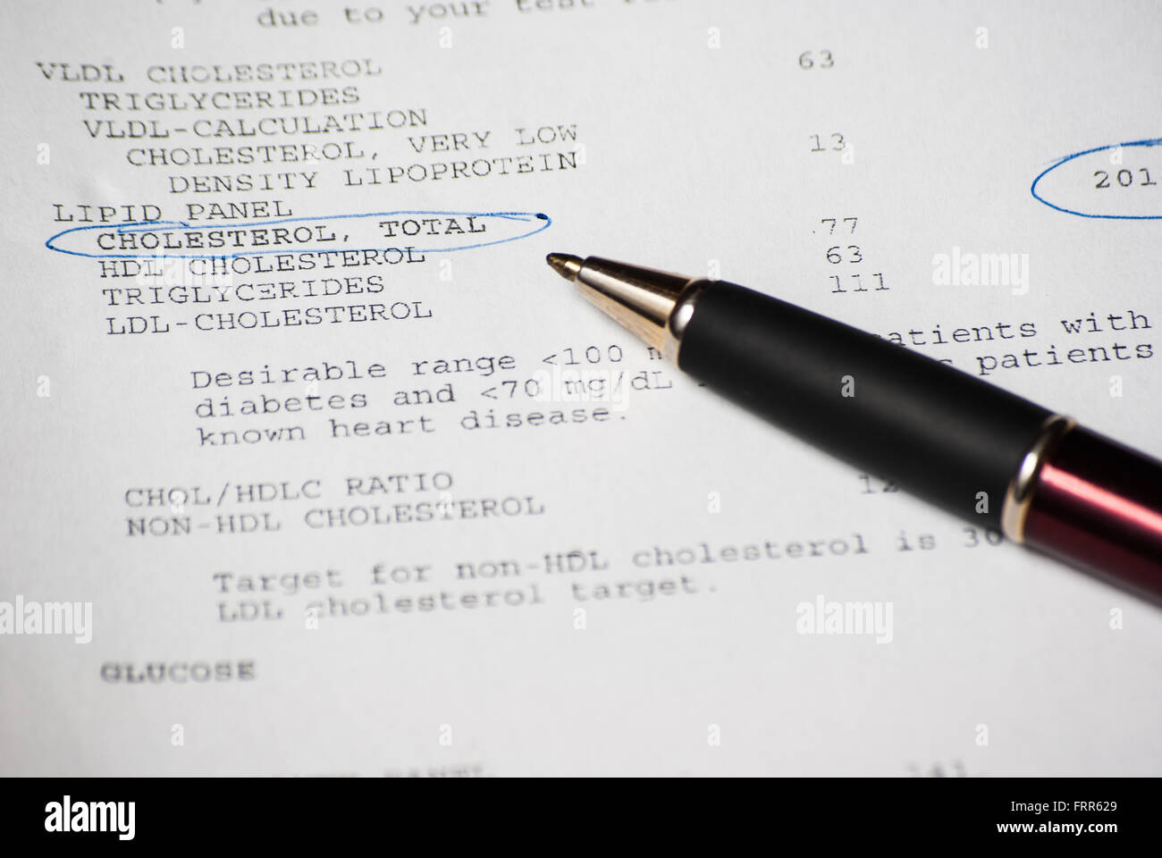 Focus on the cholesterol in a blood test report concept of better ...