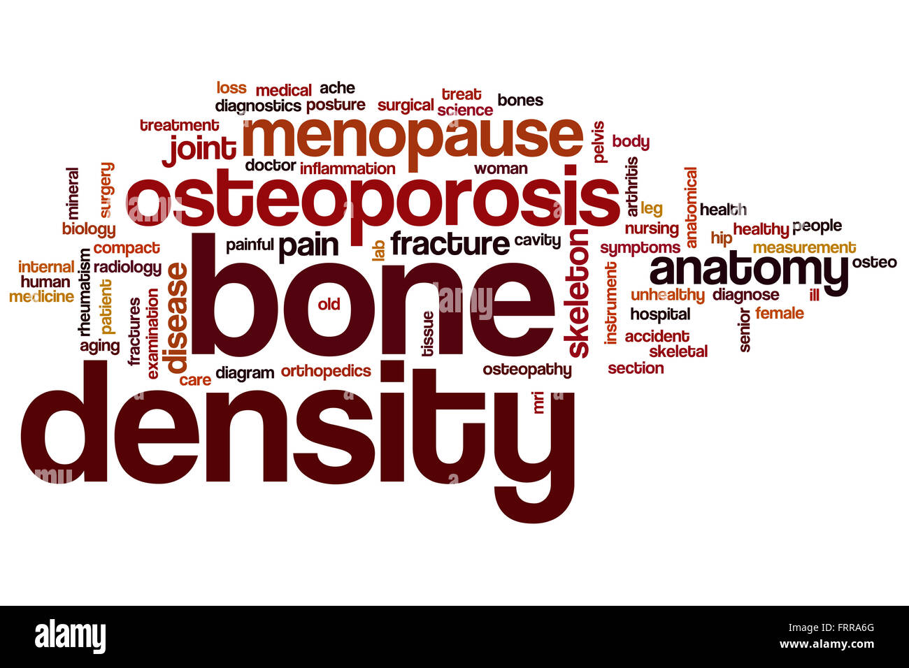 Bone density word cloud concept Stock Photo - Alamy