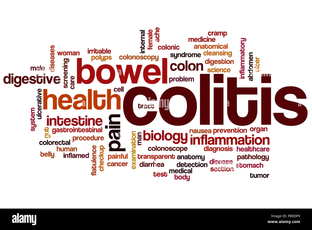 Colitis hi-res stock photography and images - Alamy