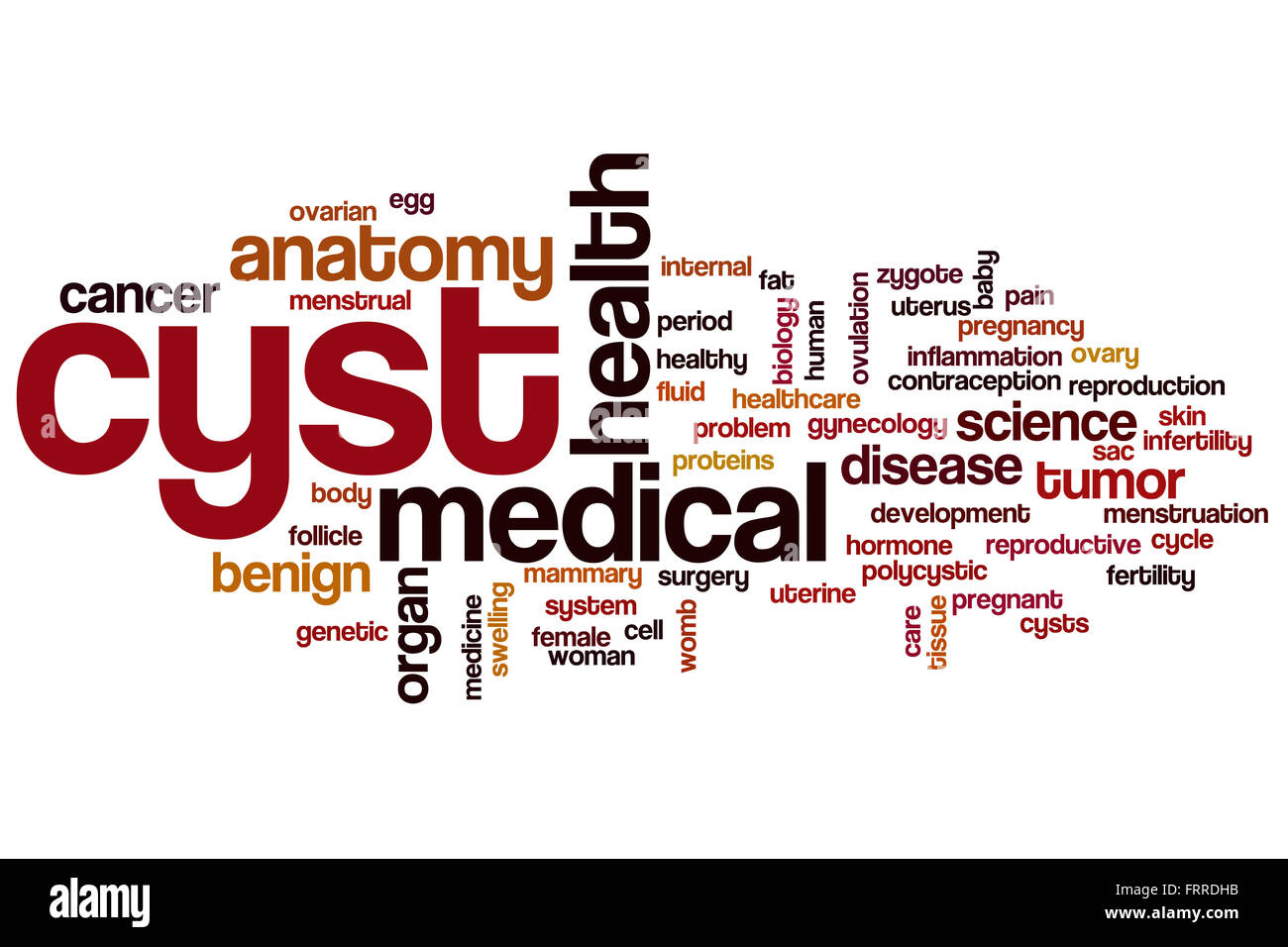 Ovarian cyst hi-res stock photography and images - Alamy