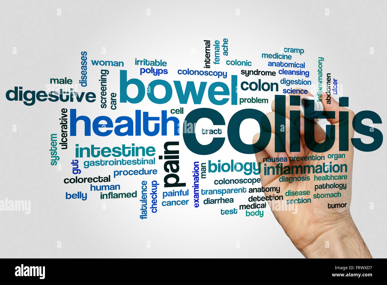 Cancer ulcerative colitis hi-res stock photography and images - Alamy