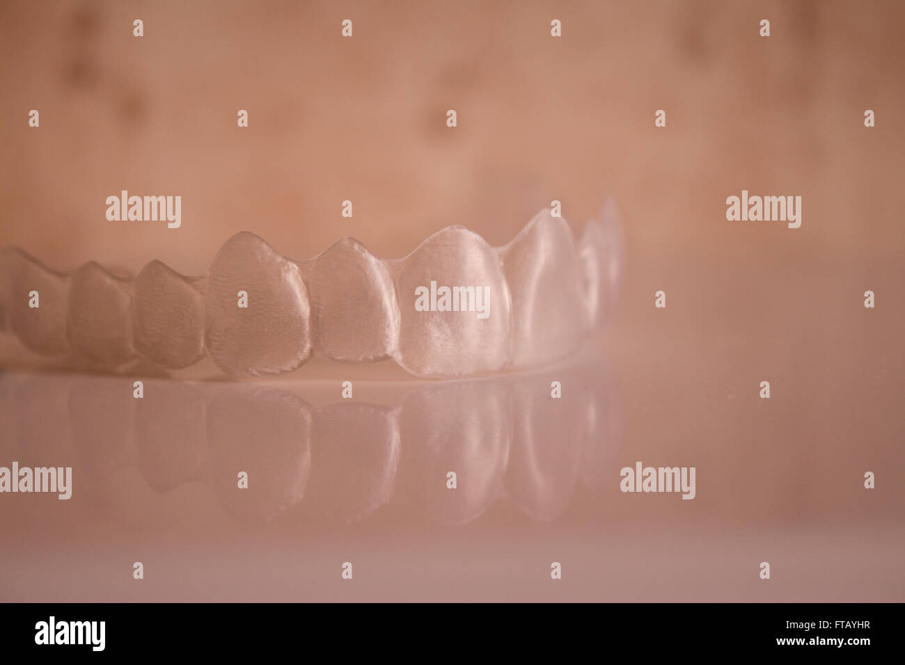 Teeth invisible brackets orthodontic dental hi-res stock photography ...