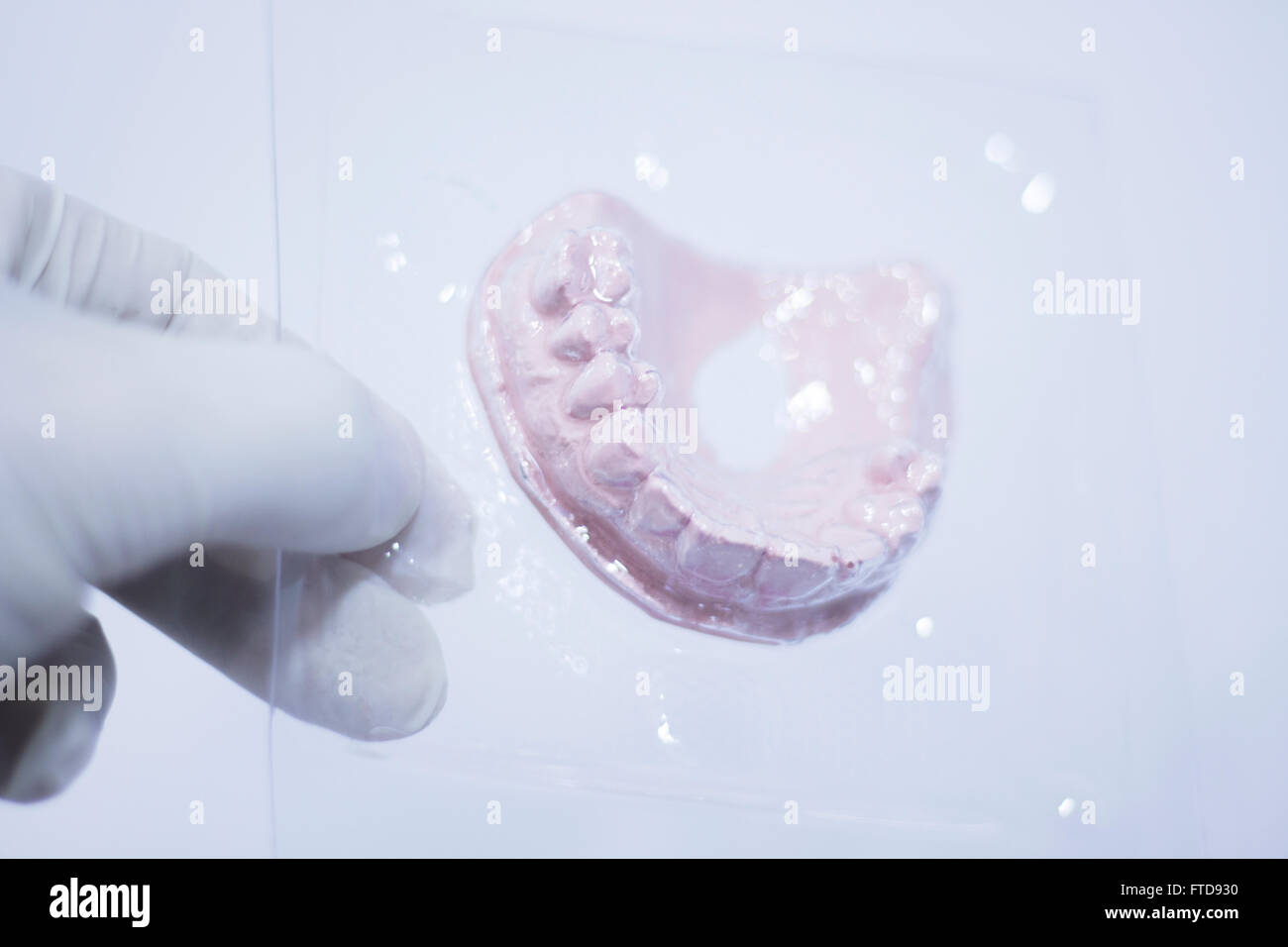 Dentists' dental teeth prosthetic mould in clinic Stock Photo - Alamy
