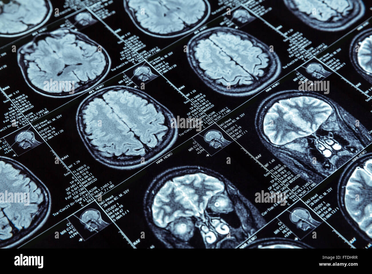 Magnetic resonance imaging Stock Photo - Alamy