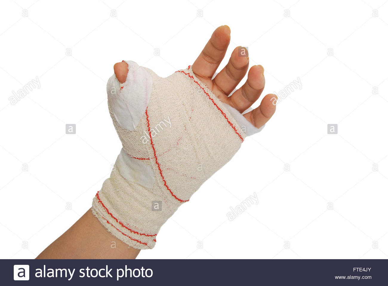 Bandaging Wound Stock Photos & Bandaging Wound Stock Images - Alamy