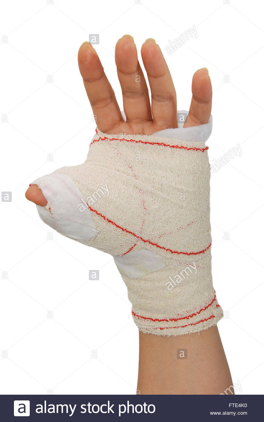 Bandage Arm Stock Photos & Bandage Arm Stock Images - Alamy
