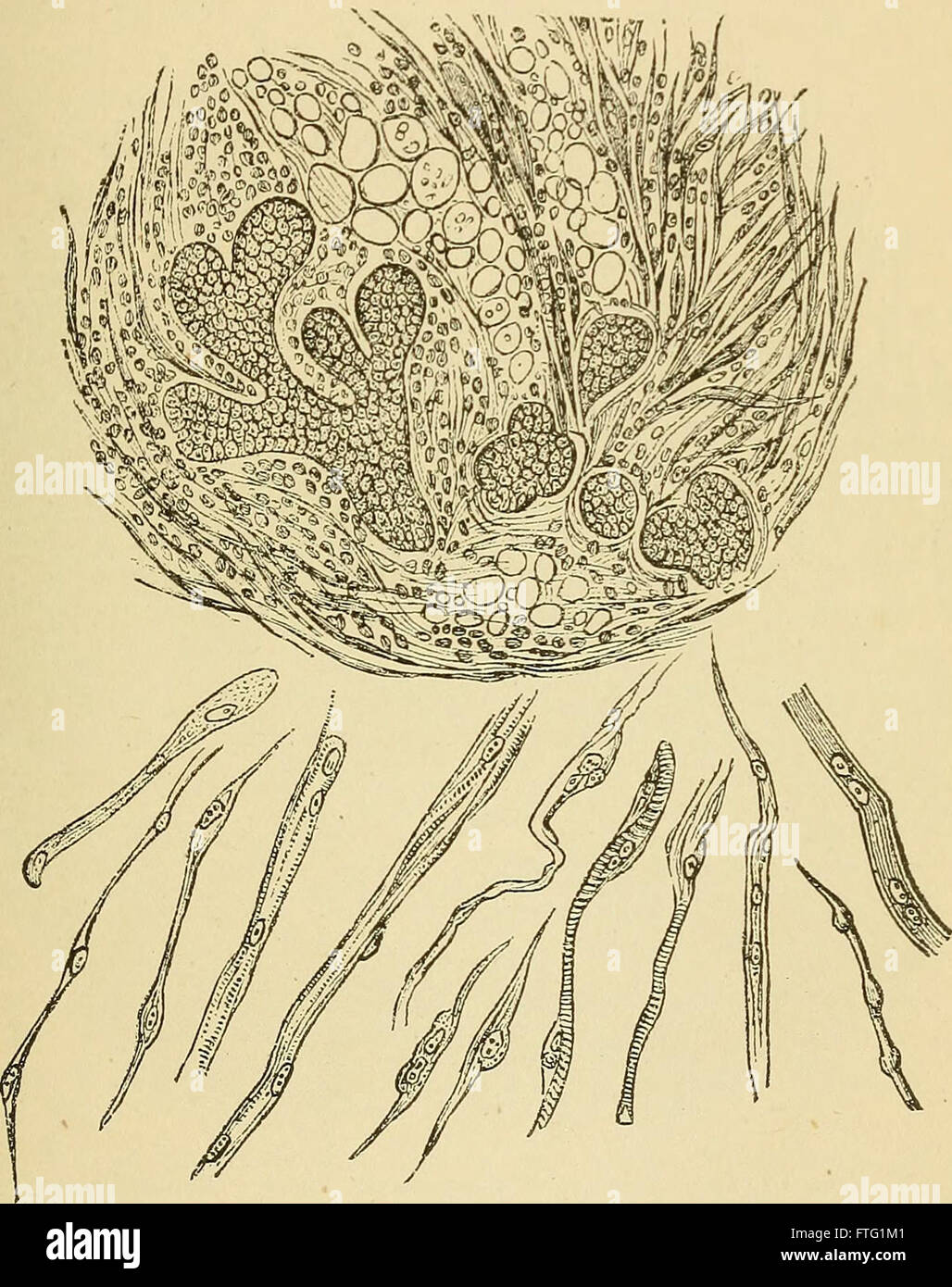 A comprehensive medical reference from 1887, covering the field of ...