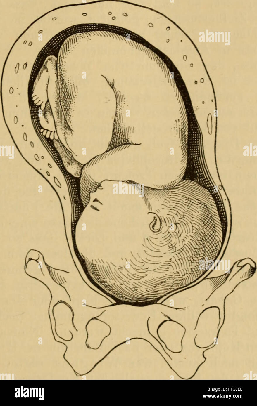 'Handbuch der Geburtshülfe' (1888) is a comprehensive guide to ...