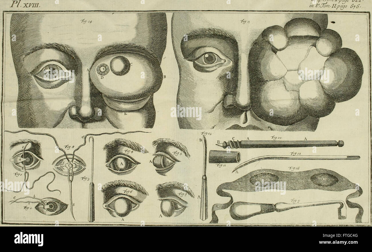 'Institutions de chirurgie' is a detailed French work on surgery ...