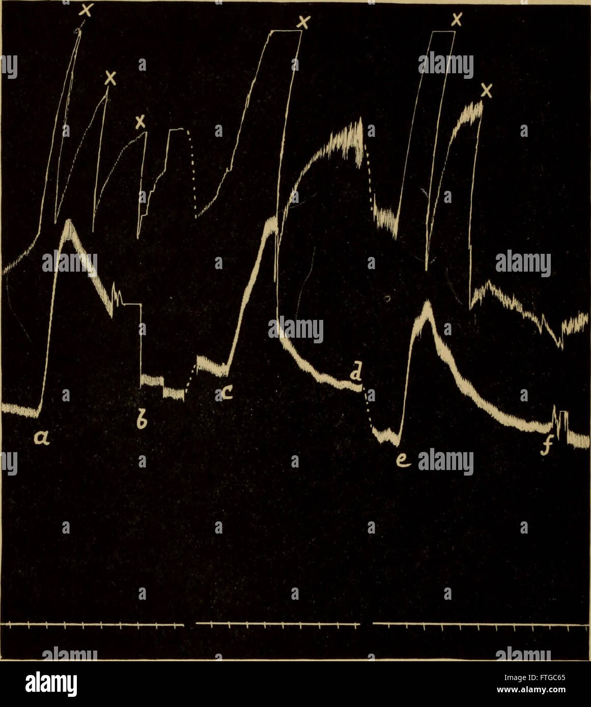 This 1918 publication discusses intravenous injection in treating wound ...
