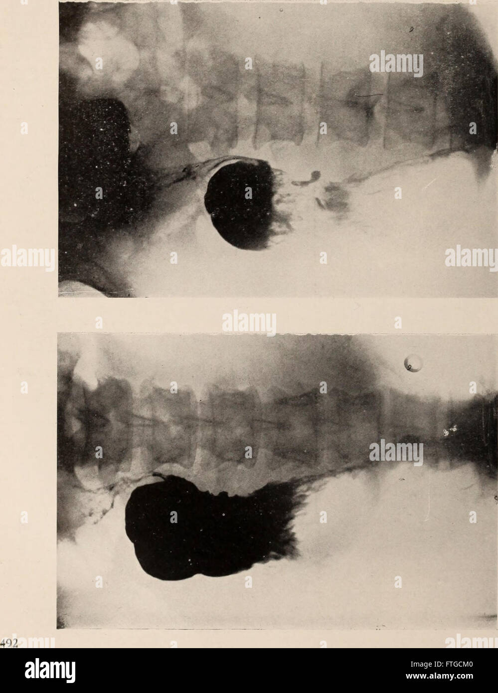 *Journal of Radiology* (1922) covers developments in the field of ...