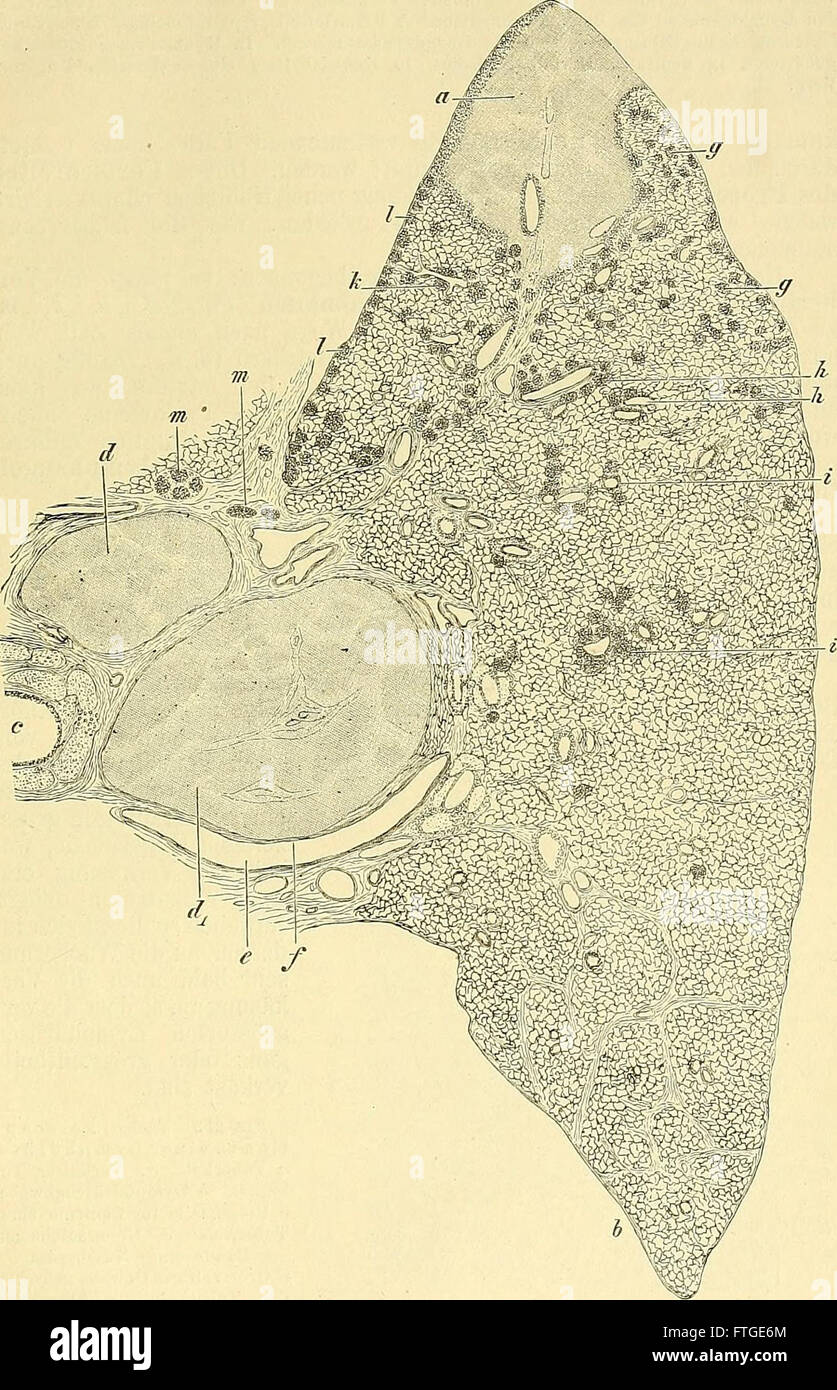A comprehensive 1889 textbook on general and special pathological ...
