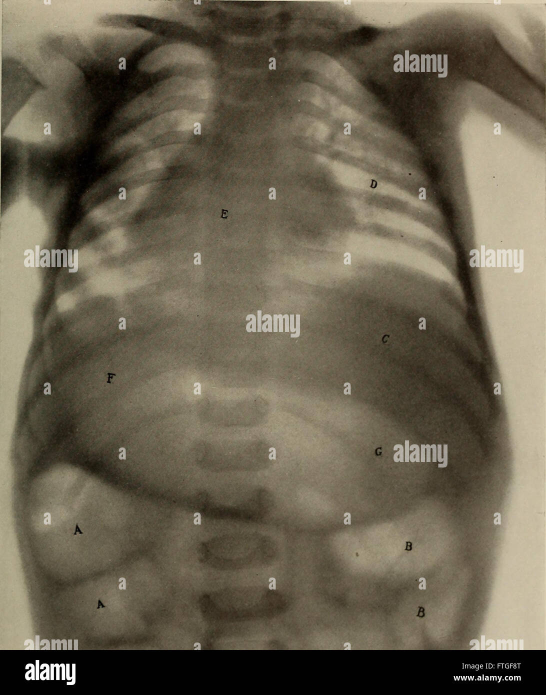 'Living Anatomy and Pathology' (1910) explores the human body through ...