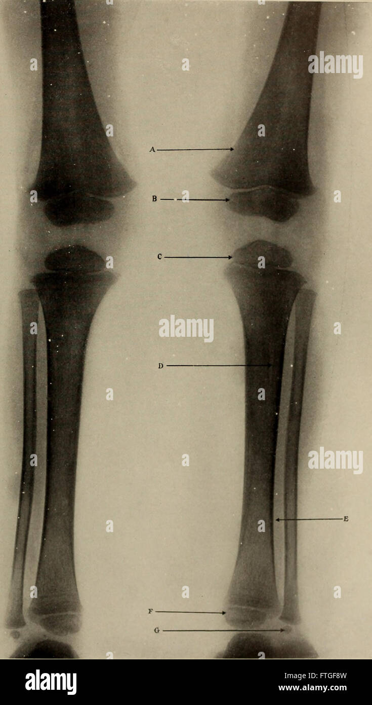 A 1910 text discussing the field of living anatomy and pathology ...
