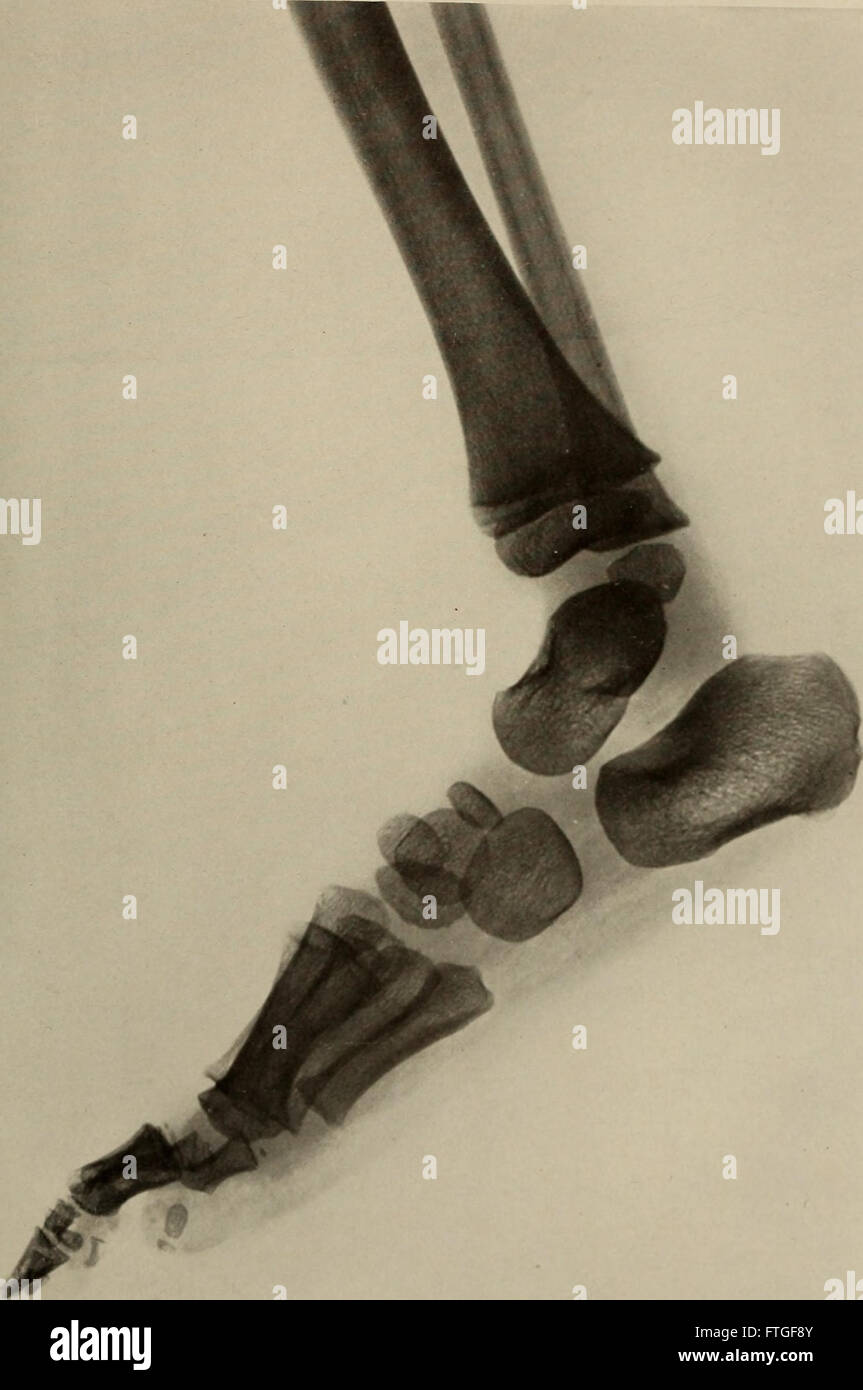 A 1910 work on living anatomy and pathology, detailing the structure ...