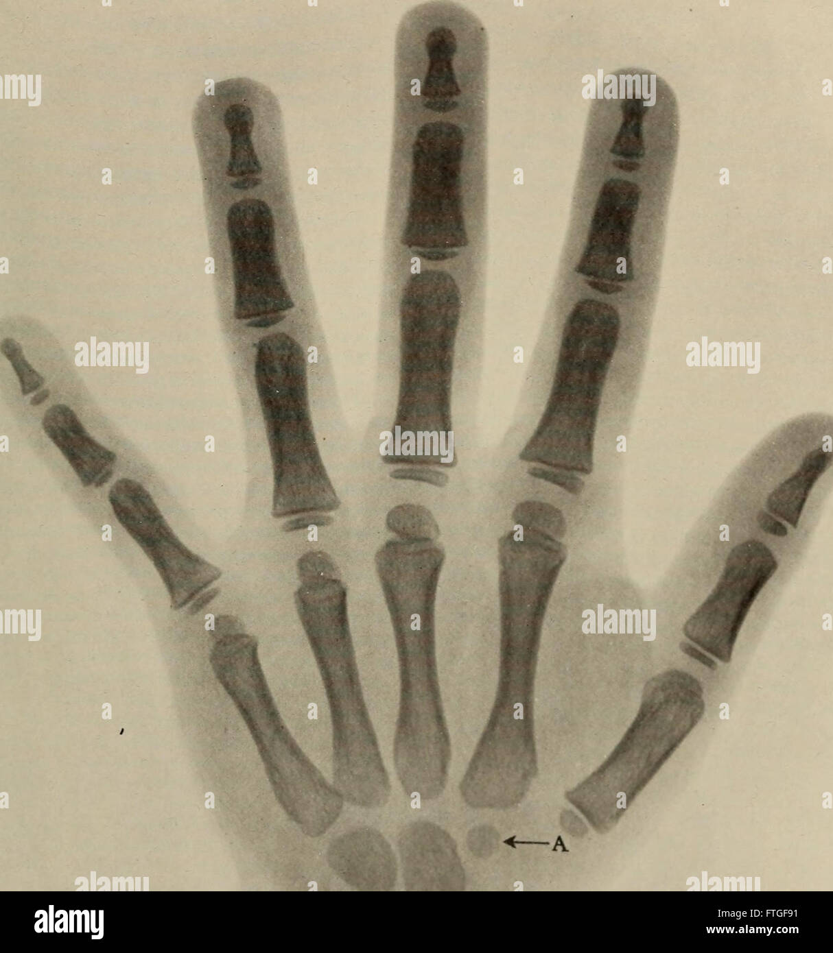 'Living Anatomy and Pathology' (1910) covers the study of human anatomy ...