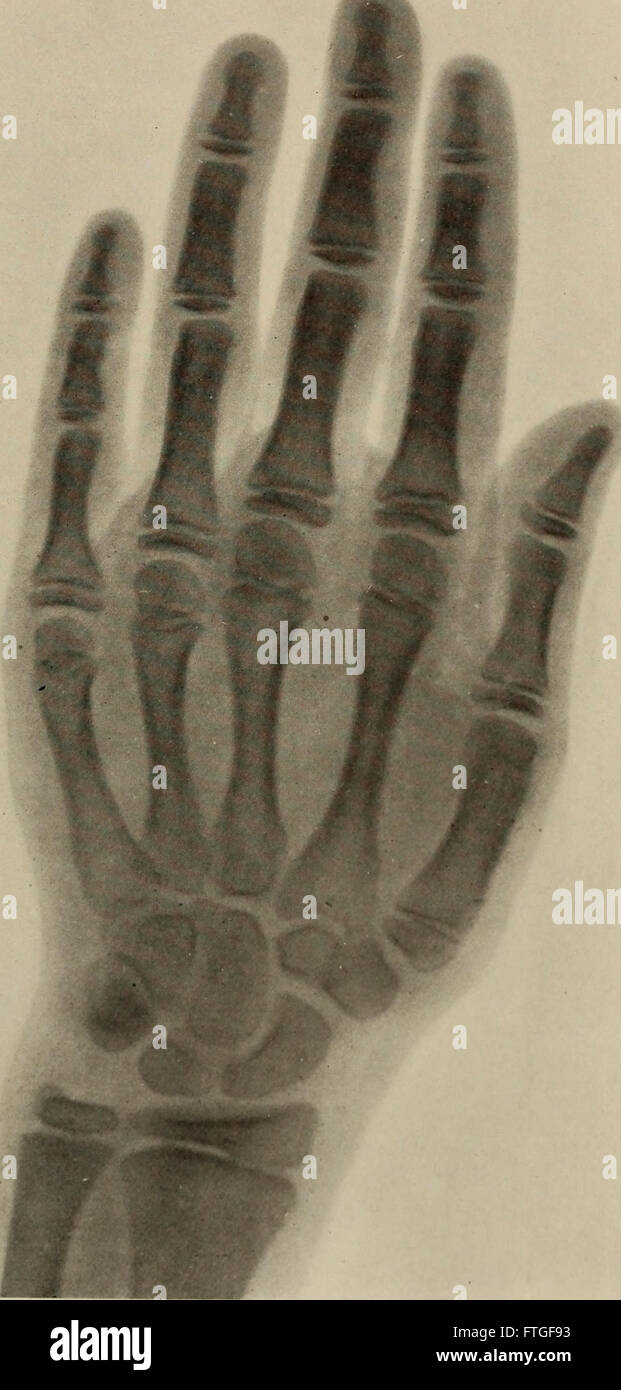 A 1910 reference text on living anatomy and pathology, exploring human ...