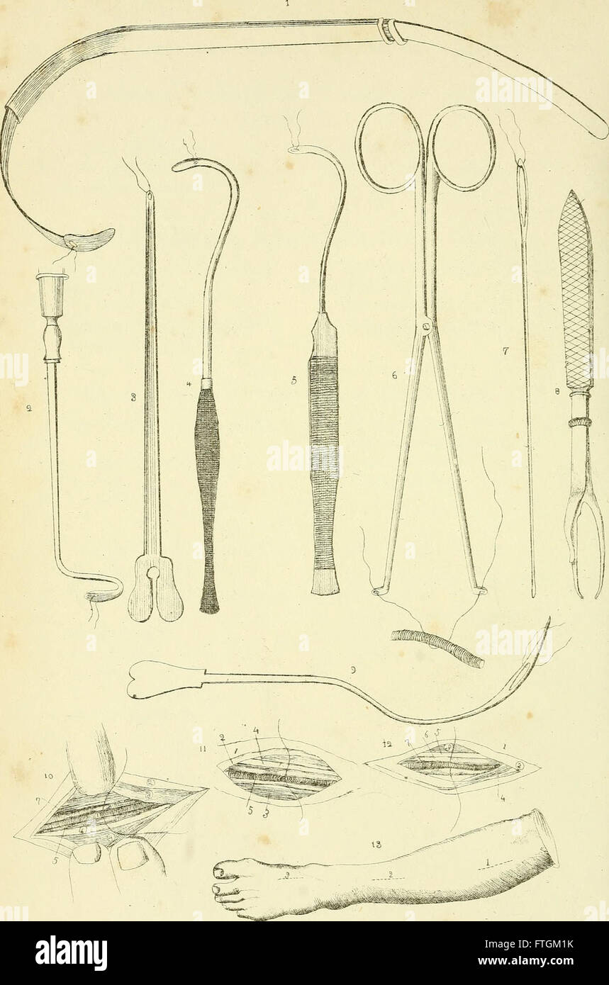 A 1852 surgical reference book featuring over 1,900 engravings ...