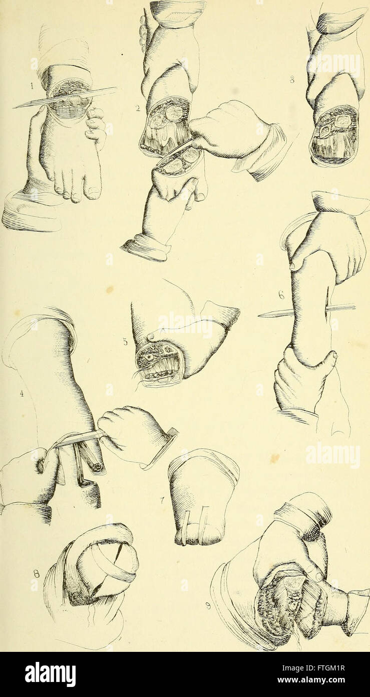 'Operative Surgery Illustrated' (1852) provides a comprehensive guide ...