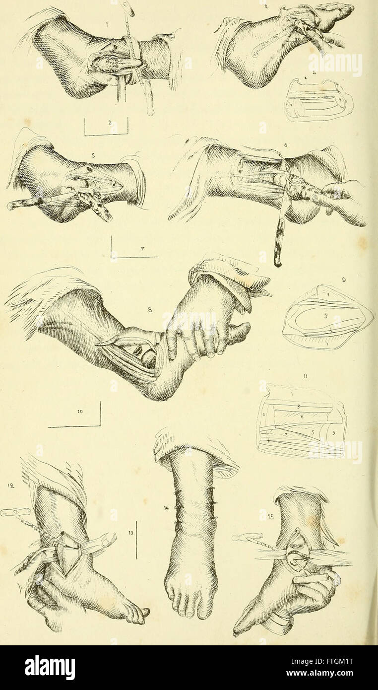 A 1852 illustrated medical text offering detailed explanations and over ...