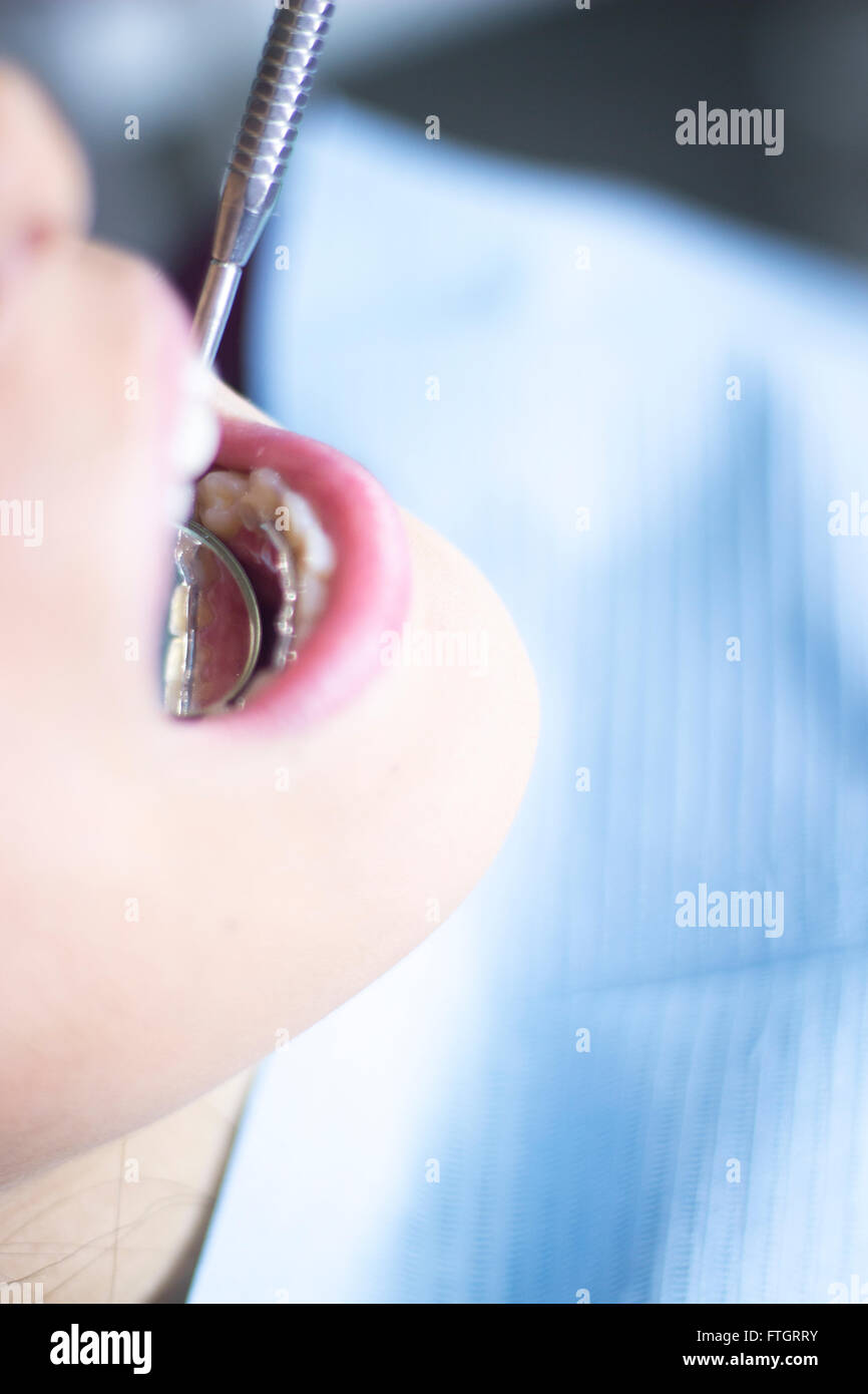 Dentist examining patient mouth in dental exam with dentist's ...