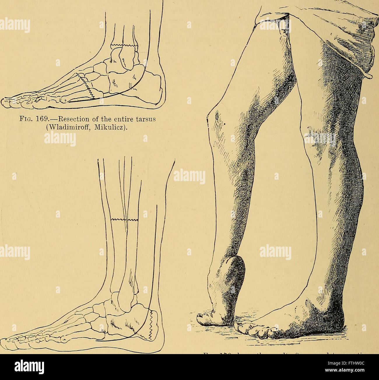 A 1903 medical textbook focusing on the principles and techniques of ...