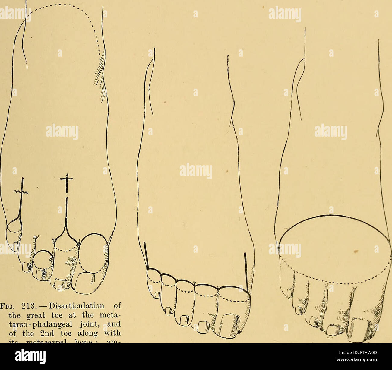 *Text-book of Operative Surgery* (1903) is a detailed manual on ...