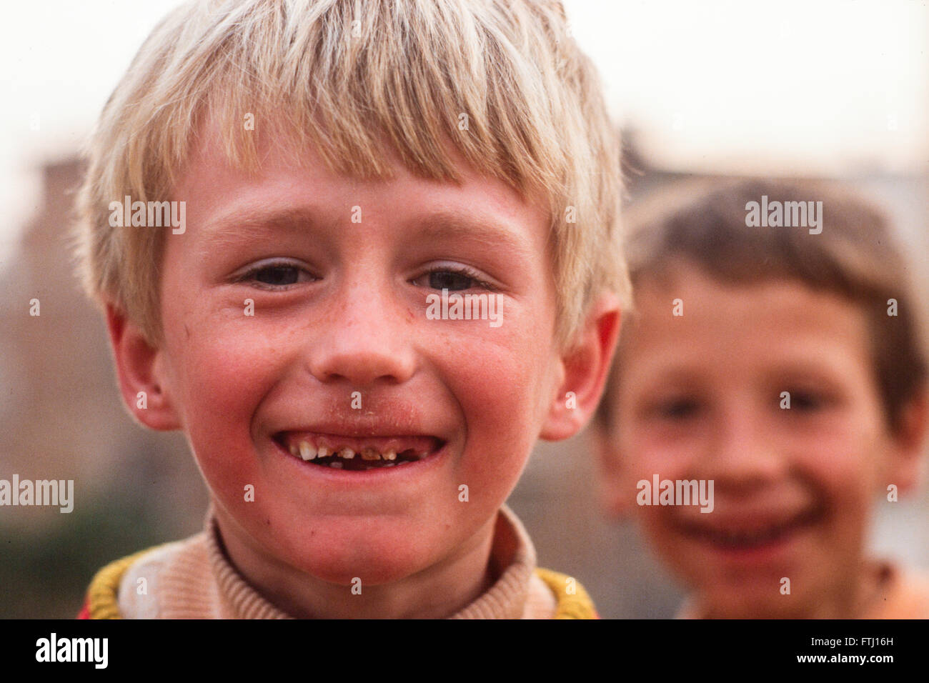 Rotten Teeth From Candy