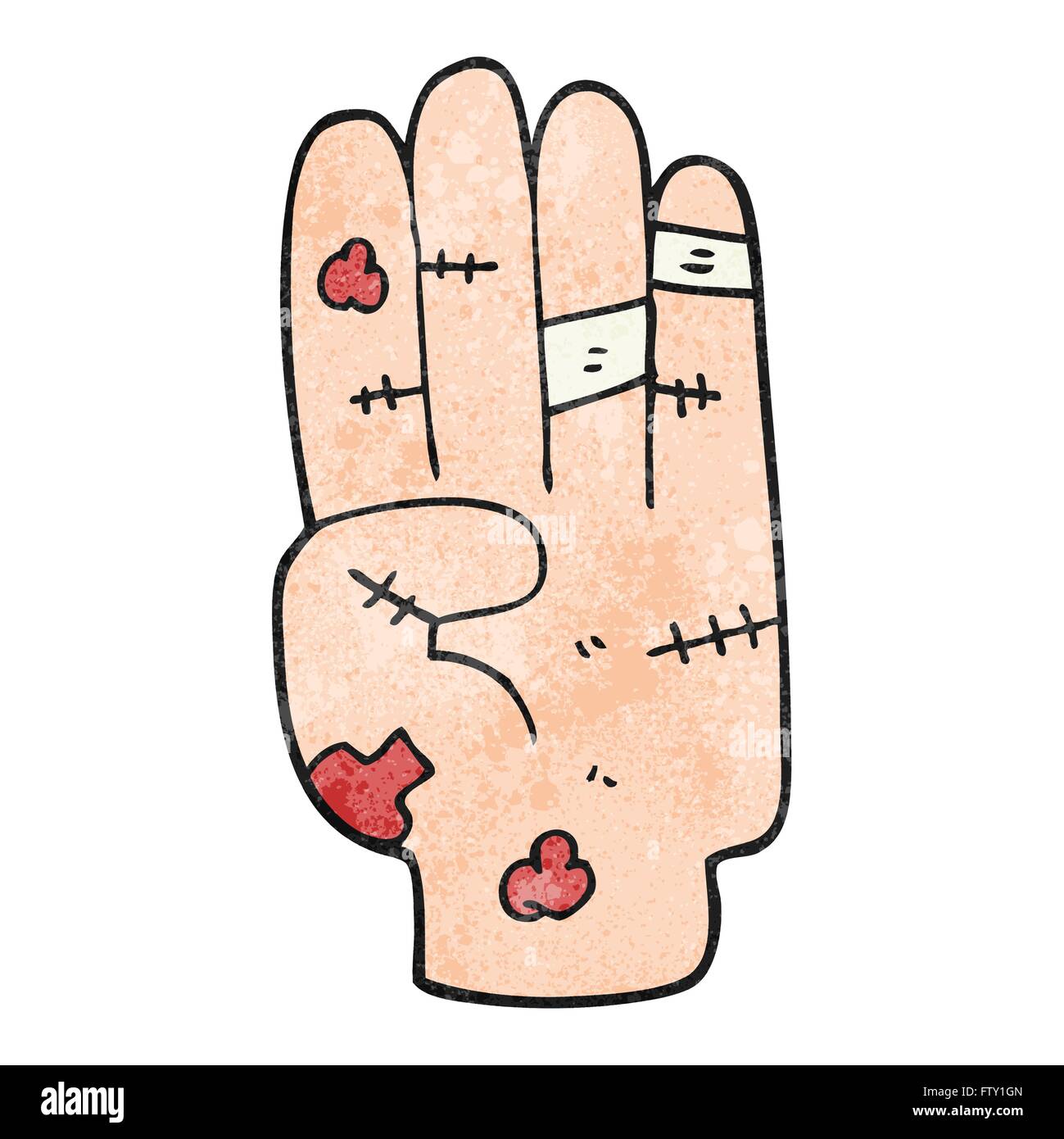 Hand injury bruise Cut Out Stock Images & Pictures - Alamy