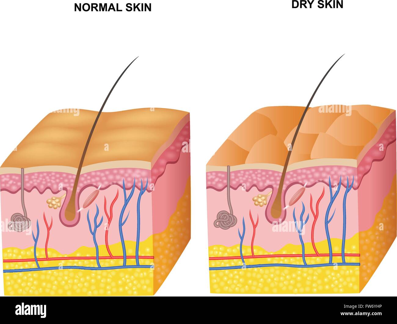 Illustration of The layers normal skin and dry skin Stock Vector Image ...