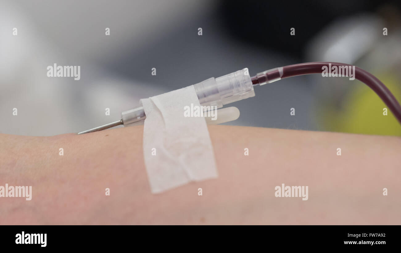 Donor in an armchair donates blood at hemotransfusion station, close-up ...