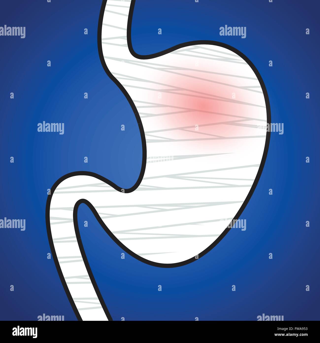Stomach injuries on a blue background. Illustration Stock Vector Image ...