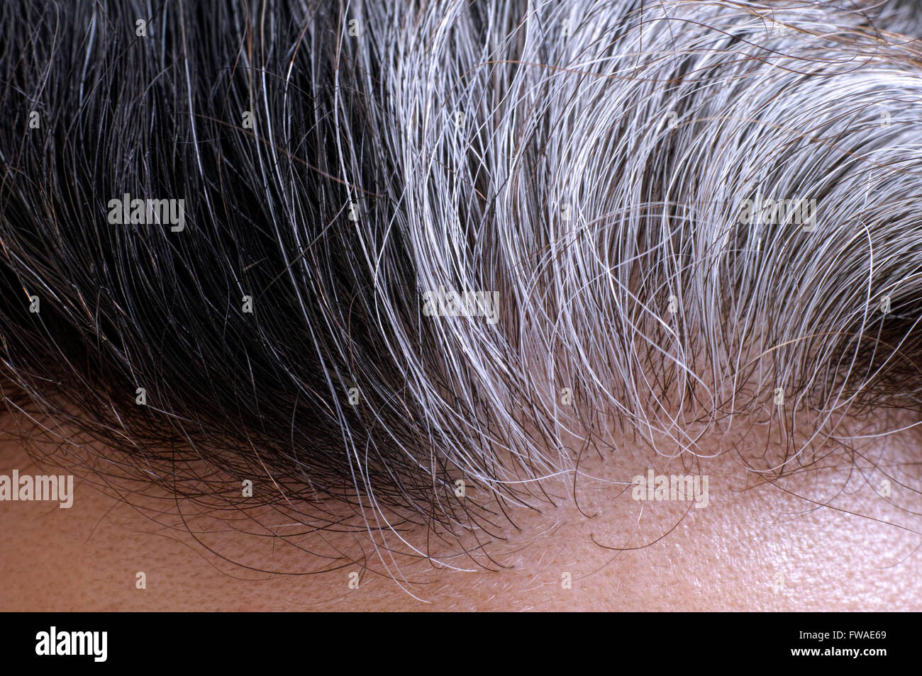 Hair roots showing hi-res stock photography and images - Alamy