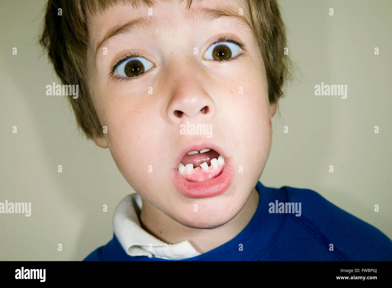 Falling out of tooth hi-res stock photography and images - Alamy