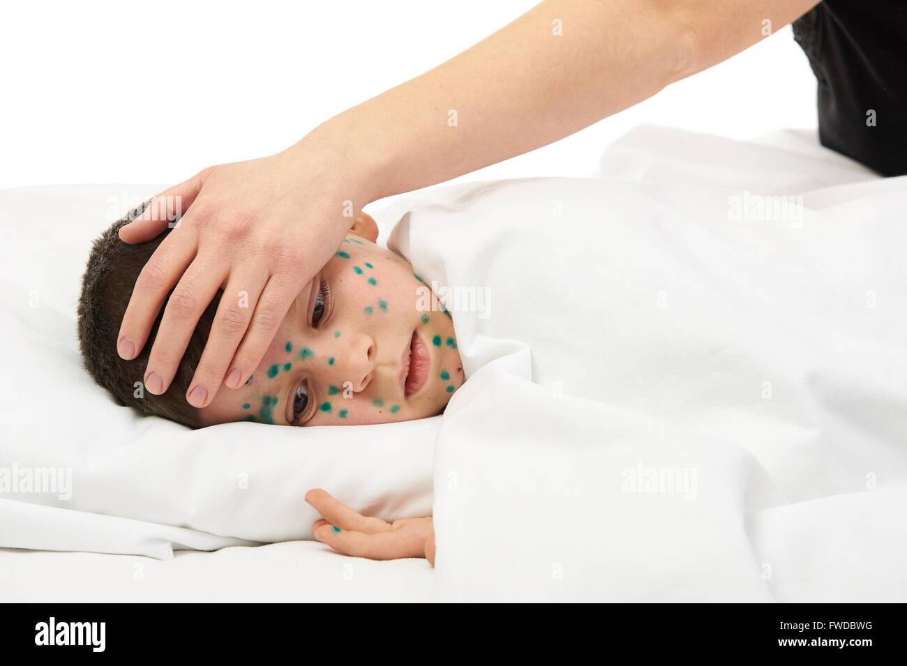 sick child has the virus on skin, mother's hand touches the forehead ...