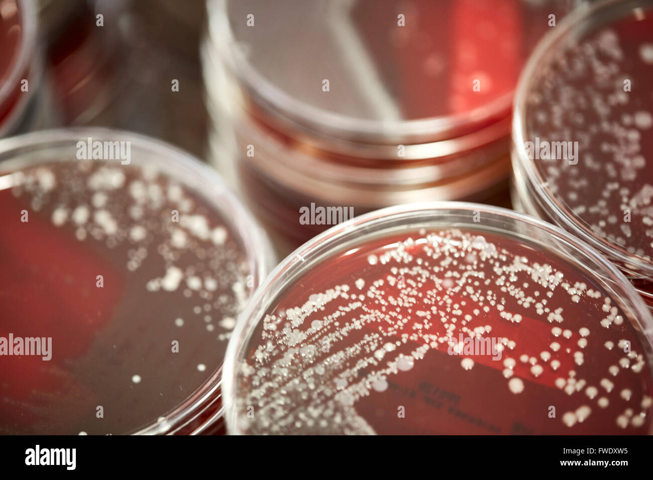 blood plates testing antibiotics liquids samples lab laboratory ...