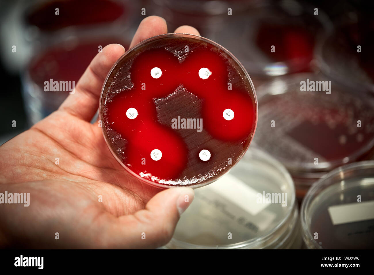 blood plates testing antibiotics liquids samples lab laboratory ...