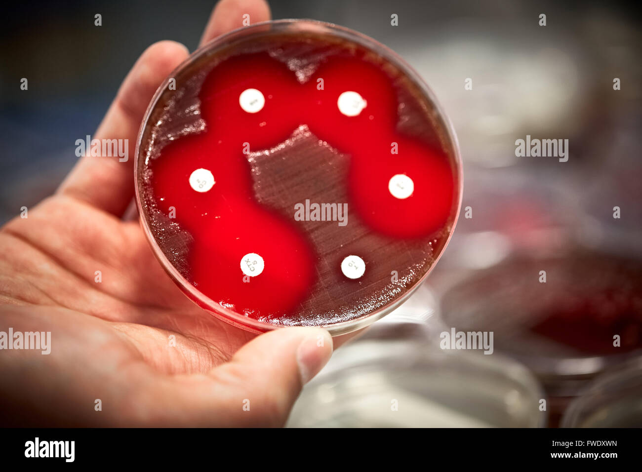 Blood serum High Resolution Stock Photography and Images - Alamy