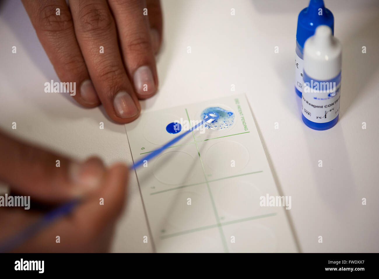 Blood tests High Resolution Stock Photography and Images - Alamy