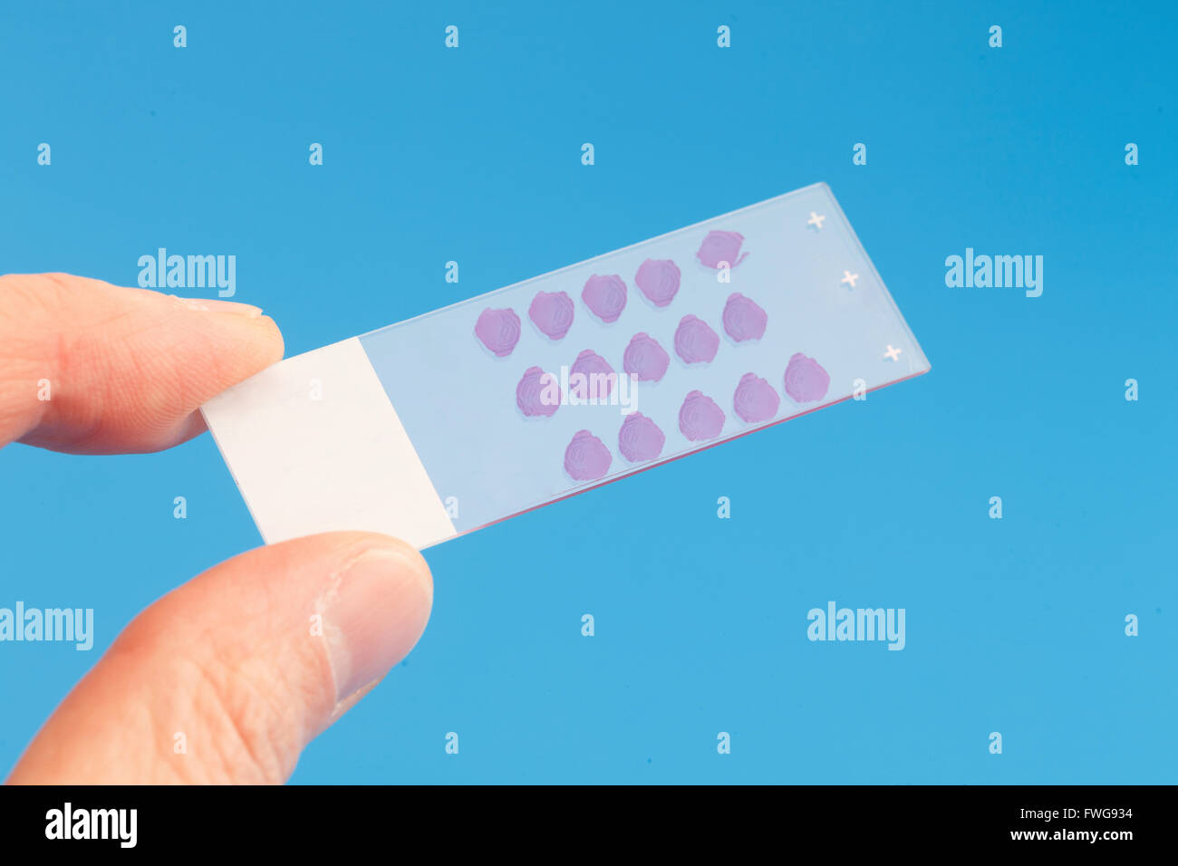 Microscope slide blue sample blood sample hi-res stock photography and ...