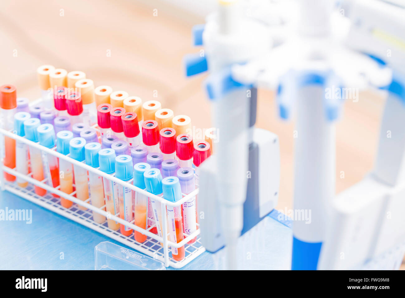 Vacutainer tubes with blood samples in the laboratory Stock Photo - Alamy