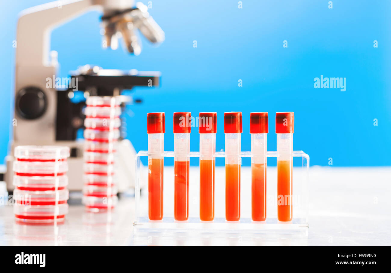 Blood samples and microscope Stock Photo - Alamy