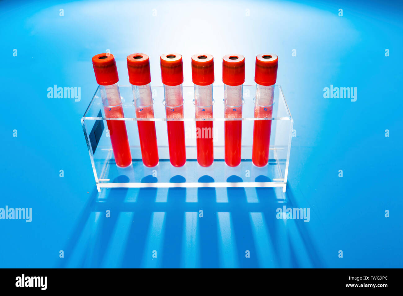 Blood samples in vacutainer tubes against a blue background Stock Photo ...