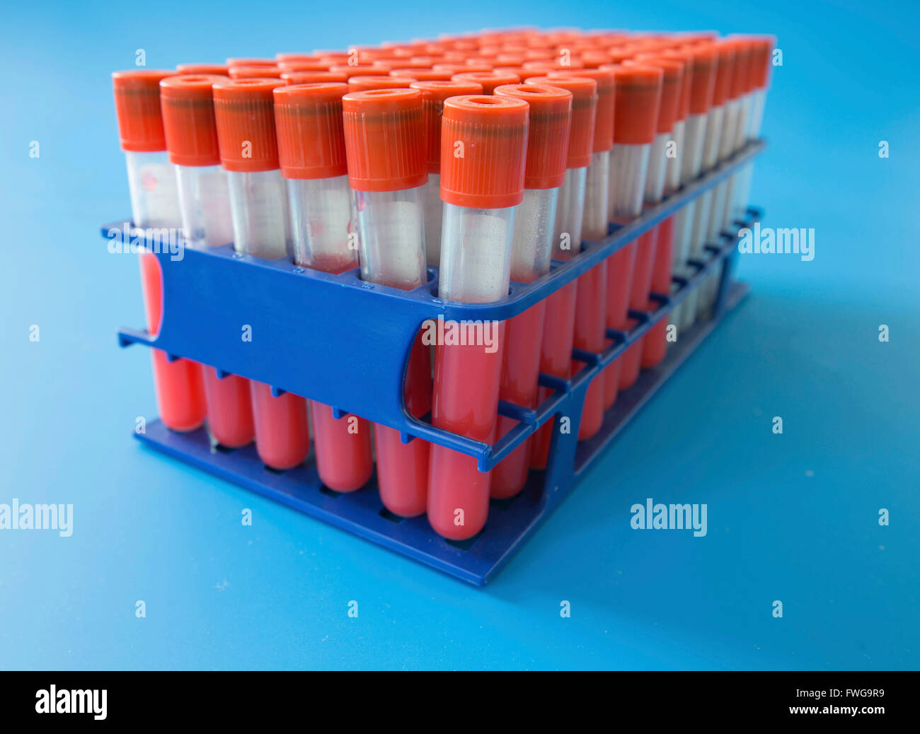 Blood samples in vacutainer tubes against a blue background Stock Photo ...