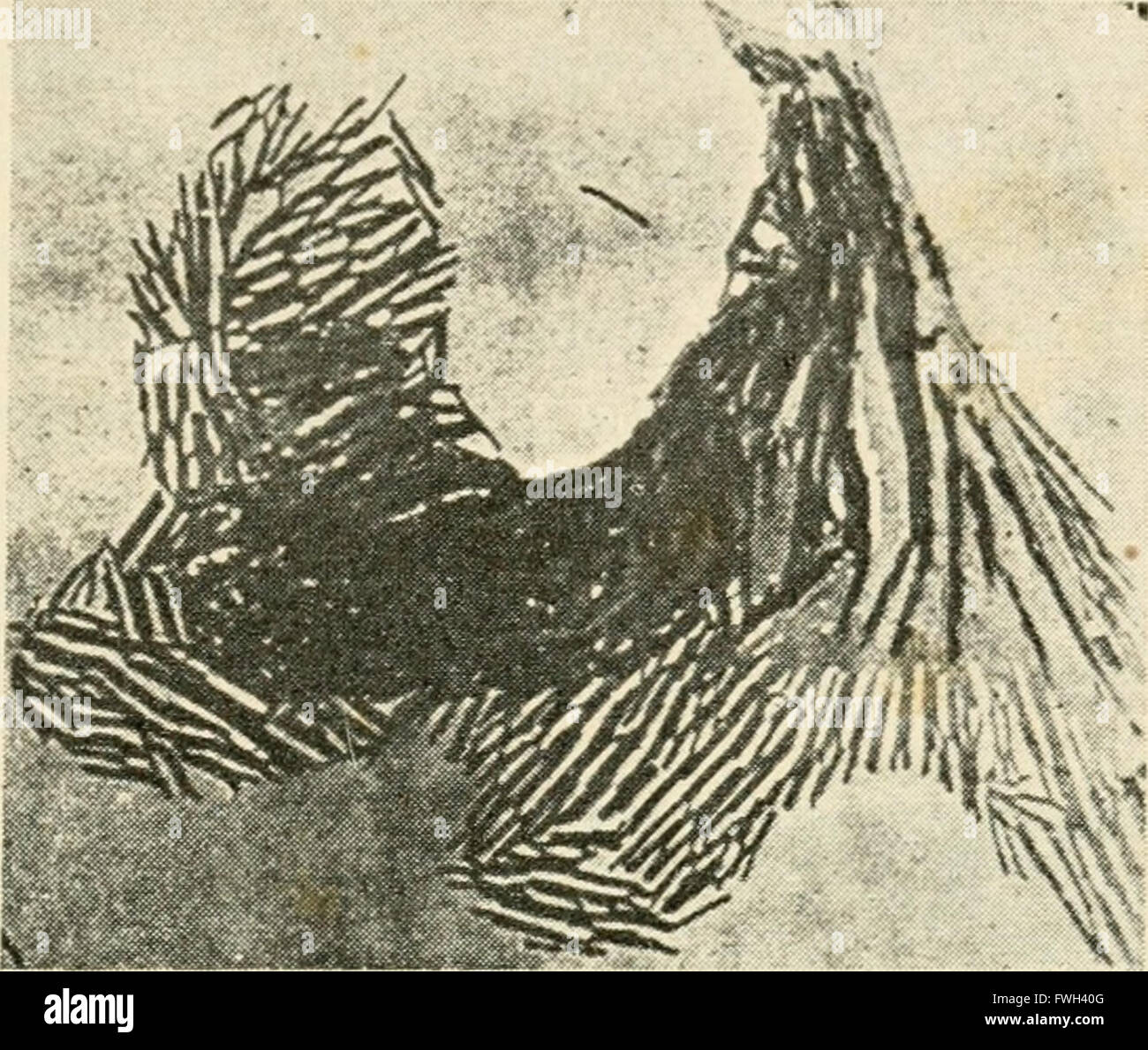 Electron microscope drawing hi-res stock photography and images - Alamy