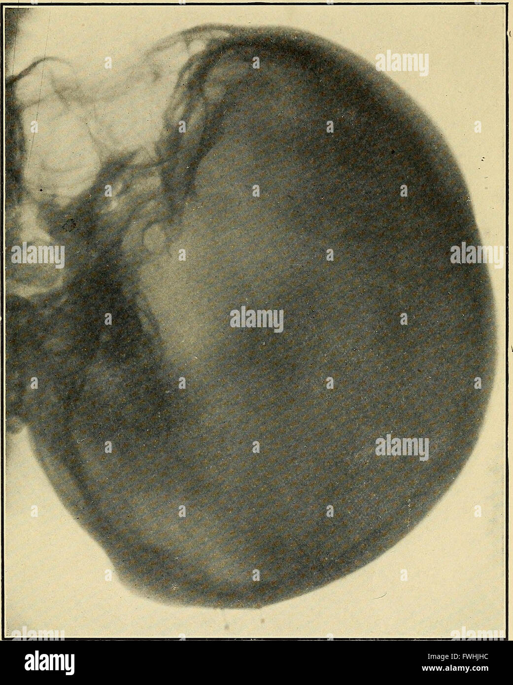 Organotherapy hi-res stock photography and images - Alamy