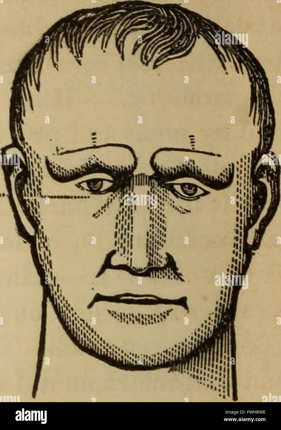 Phrenologist hi-res stock photography and images - Alamy